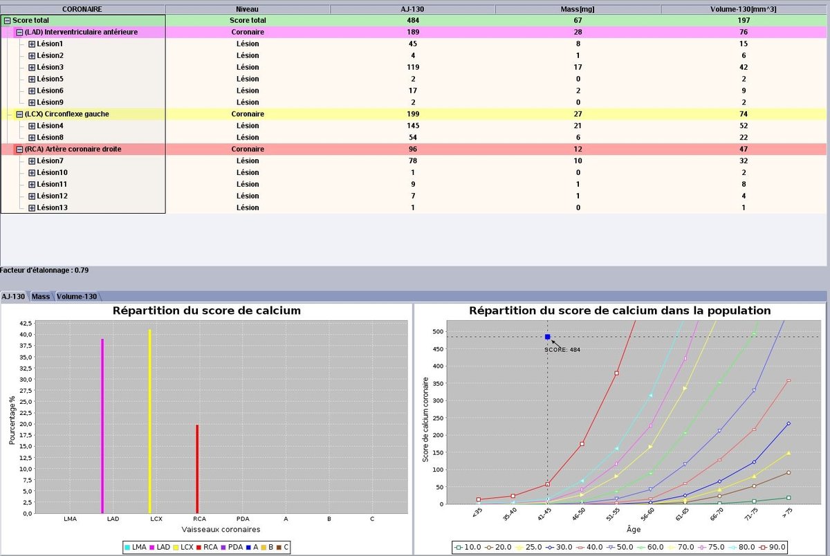 Faire évaluer son score calcique en scanner