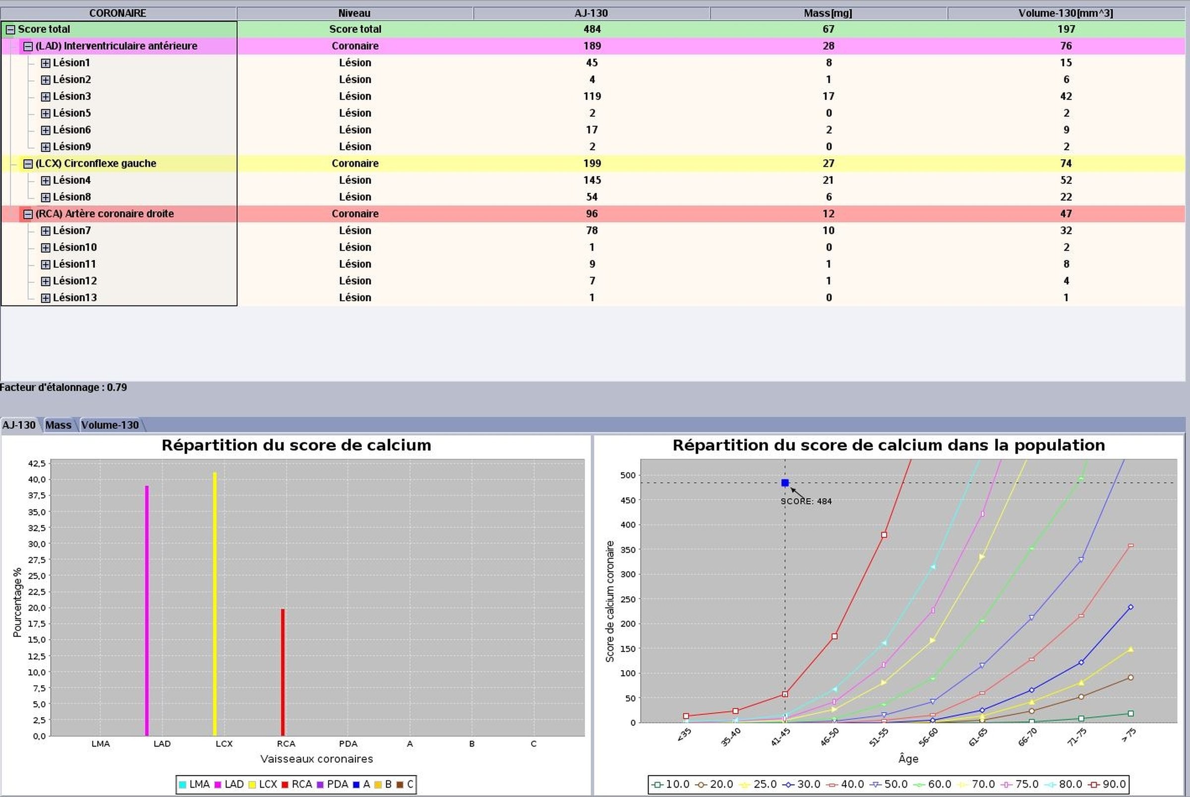 Faire évaluer son score calcique en scanner